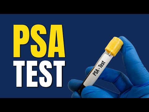 What is PSA Test? | Does A High PSA Means Cancer? | When To Get Your PSA Test? | E Healthy Info