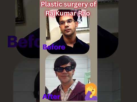 RajKumar Rao has ruined his face with surgeries #rajkumarrao #Bollywood #HindiMovies