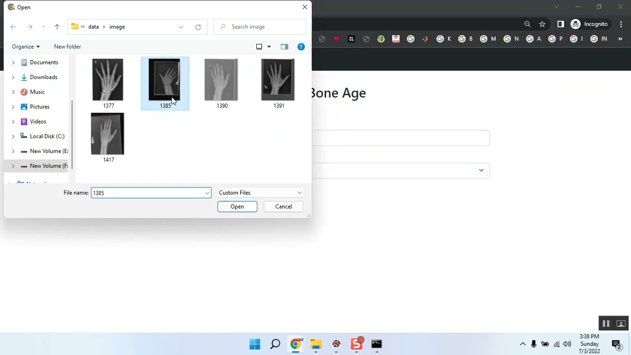 A Novel Method to Predict Knee Osteoarthritis Progression on MRI Using Machine Learning Methods