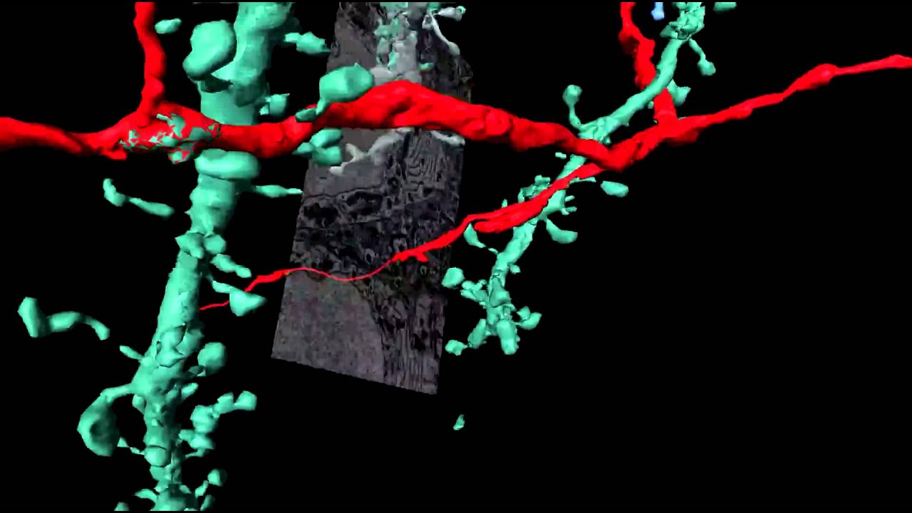 3D-reconstruction of nerve cells