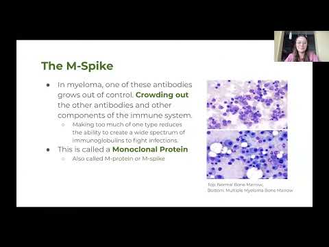 Understanding Your Myeloma Labs