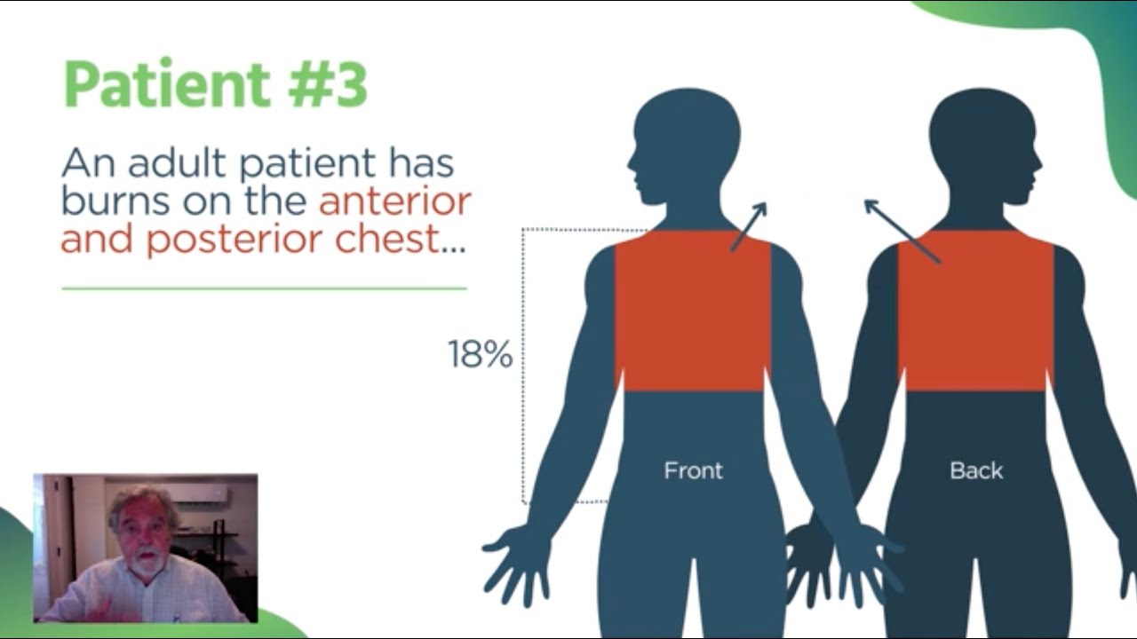 Rule of 9s Practice for EMTs: Calculating Burn Surface Area