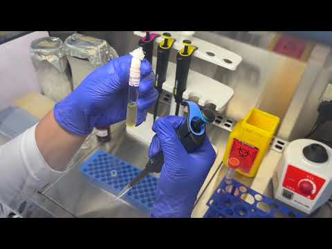 Extracting bacterial DNA using boiling lysis method