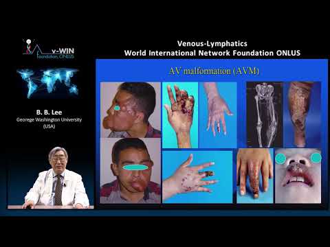 Venous & Lymphatic malformations - LEE BB