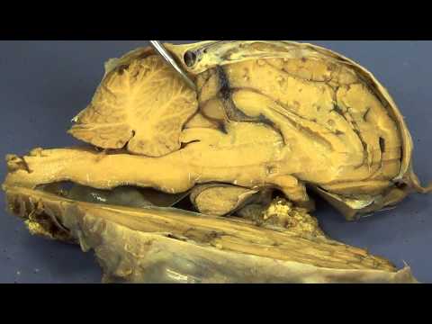 Sheep Brain Dissection