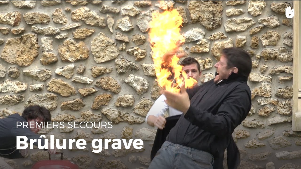 Premiers secours : Brûlure grave - Les gestes de premier secours | Sikana