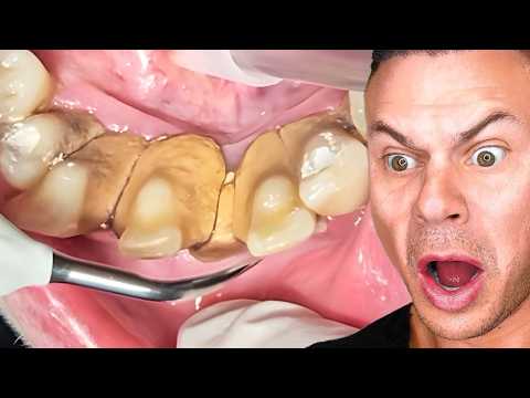 Dentist Reacts! I've NEVER Seen Teeth Like This!