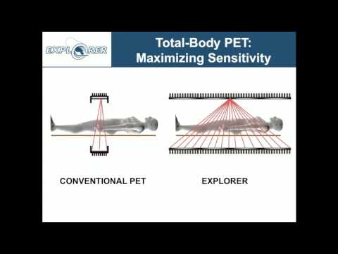 Simon Cherry: EXPLORER -- Changing the Molecular Imaging Paradigm with Total-Body PET/CT