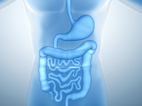 What Are Colon Polyps?