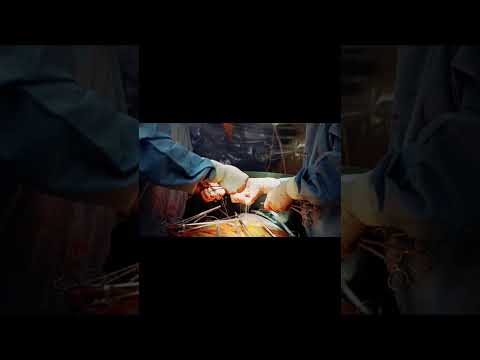 What is mediastinal Lymphadenectomy?