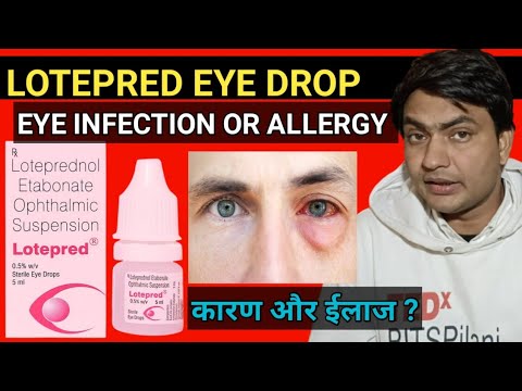 Loteprednol Etabonate Ophthalmic Suspension - Loteprednol Solution ...