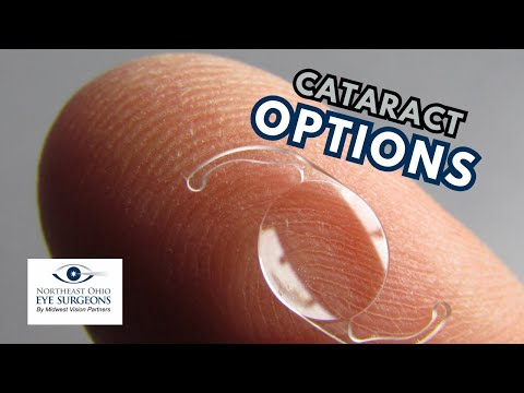 Cataract Technology Options: Dr. Michael Smit