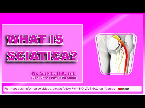 What Is Sciatica?? By - Dr. Vaishali Patel