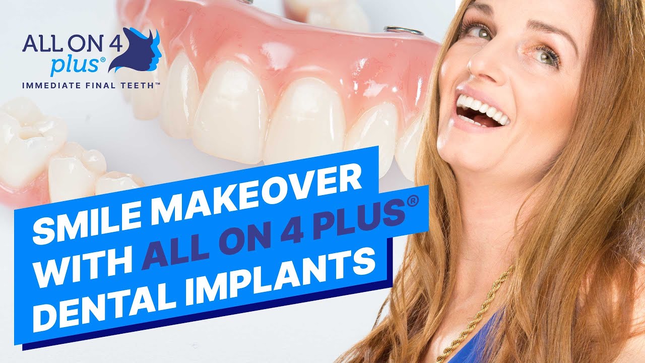 Smile Makeover with ALL ON 4 Dental Implants