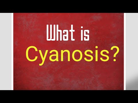 What is cyanosis?