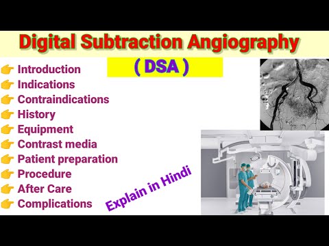 DSA ( Digital Subtraction Angiography)# DSA Procedure # Cath lab # in hindi # By BL Kumawat #