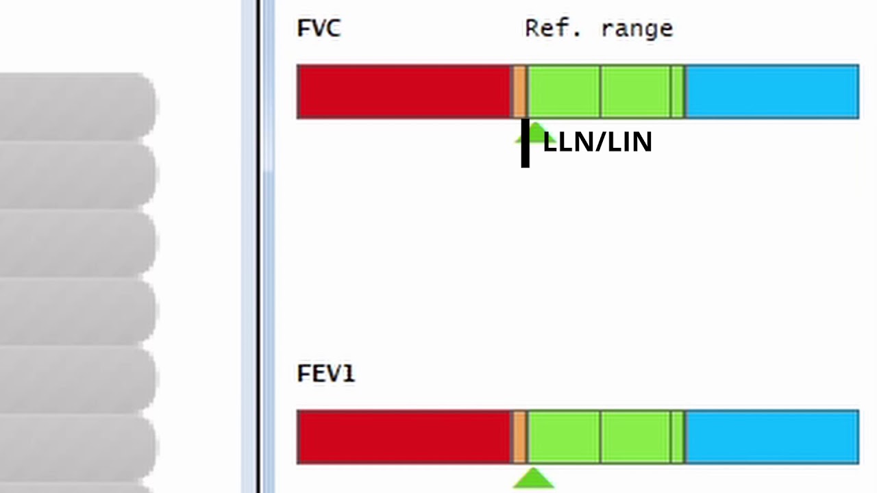 Software W20s. Spirometry