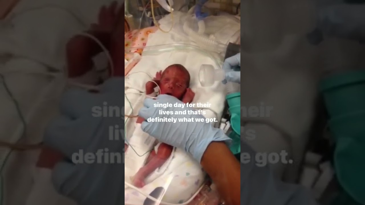 How to Support #Prematurity Awareness #nicu #nicubaby