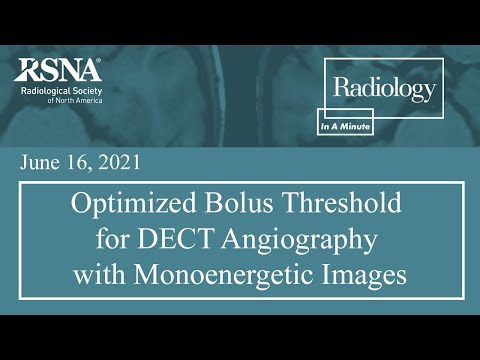 Optimized Bolus Threshold for DECT Angiography with Monoenergetic Images (CT)
