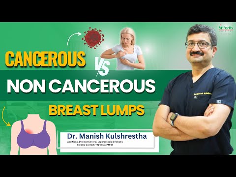 Cancerous vs Non-Cancerous Breast Lumps | Breast Lumps treatment in Hindi | Dr. Manish Kulshrestha
