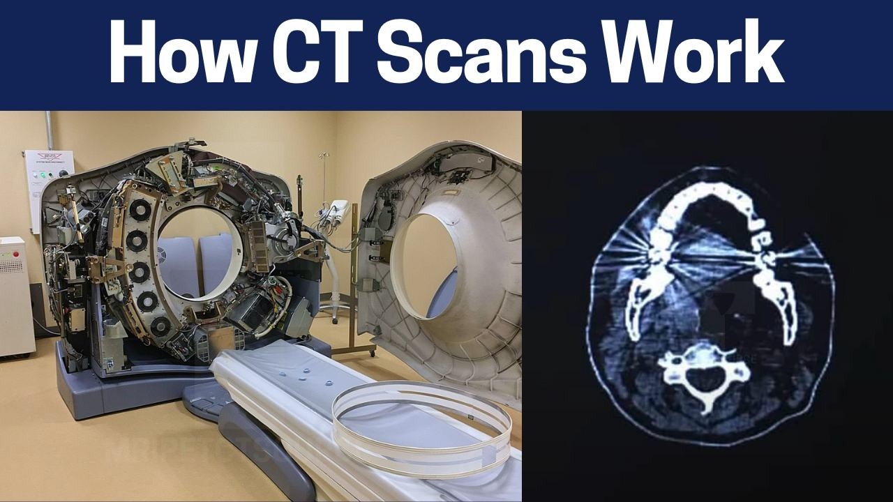 The 5-Minute Scan That Can Save Your Life