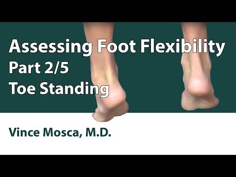 Cavovarus Foot in Pediatrics & Adults - Pediatrics - Orthobullets