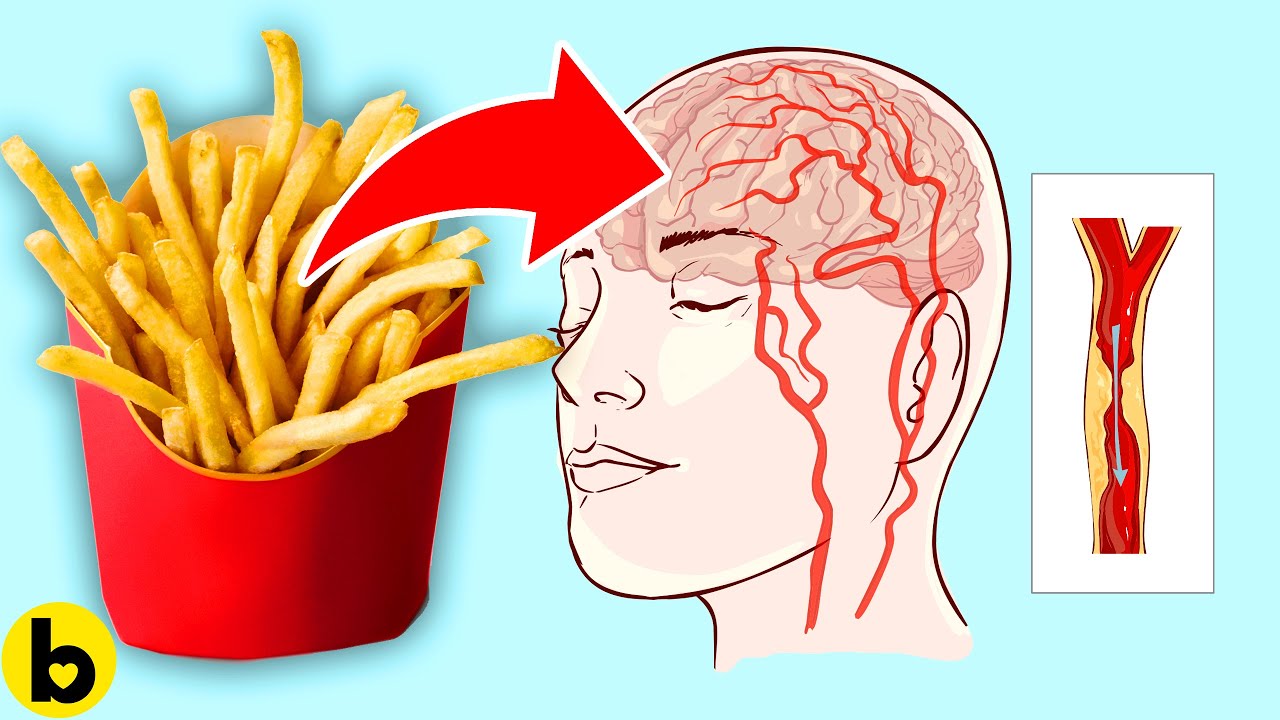 This Is What Fast Food Does To Your Brain