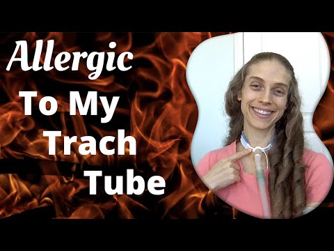 Allergic to My Tracheostomy Tube. Life with a Vent