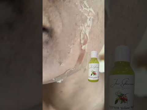 The best transformation peeling review 🔥