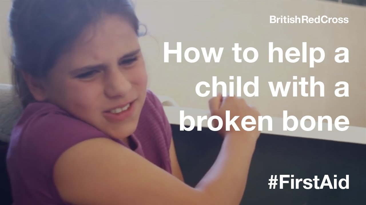 How to help a child with a broken bone #FirstAid #PowerOfKindness
