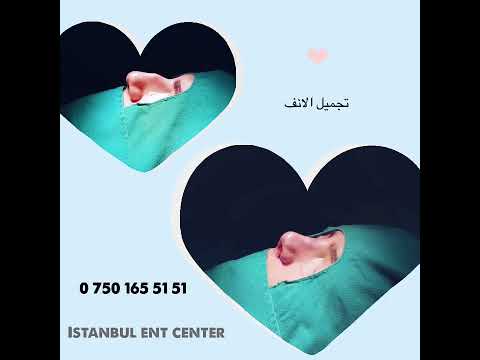 Rhinoplasty - 0 750 165 51 51 - Istanbul ENT Center
