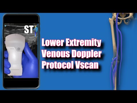 Vscan Protocol Venous Doppler Lower Extremity