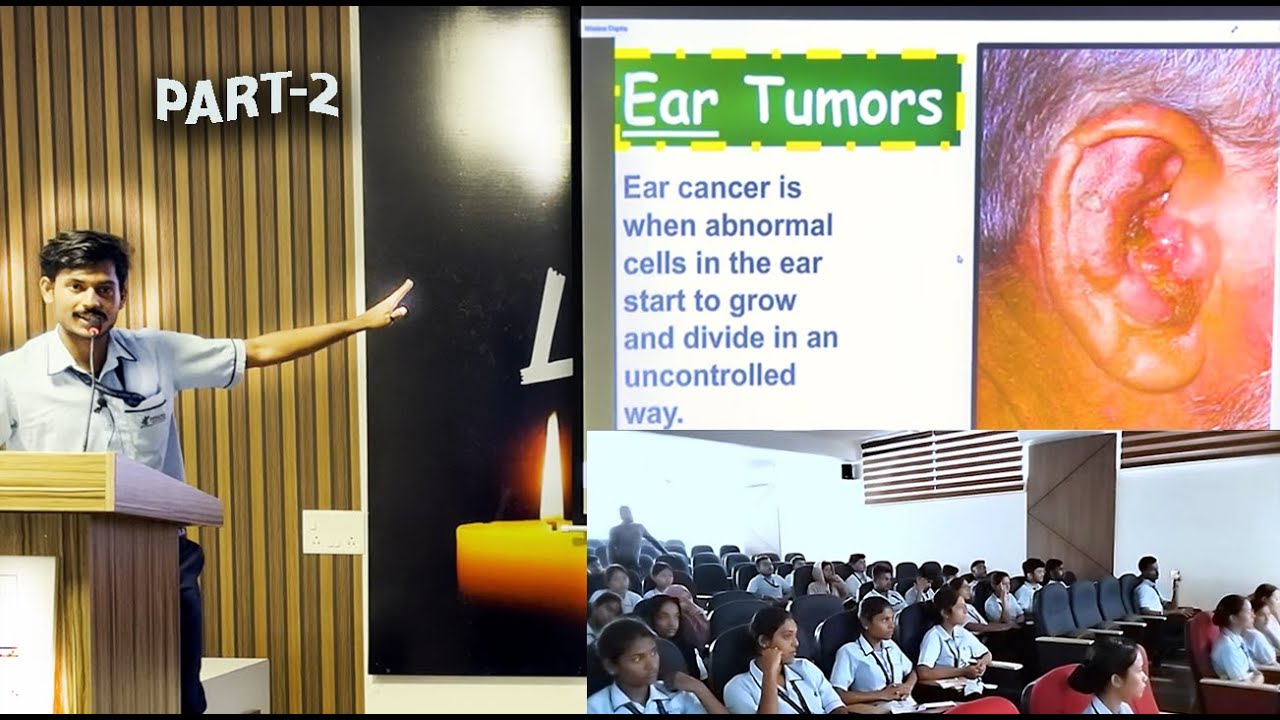 Tumors of The Ear Part-2 | External Ear Tumors
