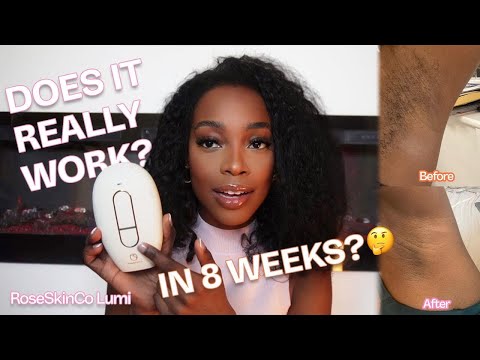 Lumi IPL by RoseSkinCo – Does It Work for Darker Skin? 8-Week Review