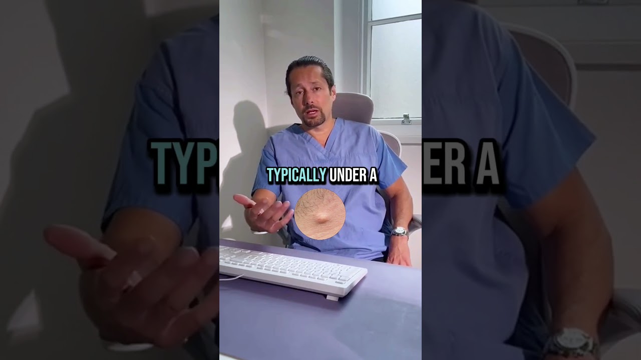 Cyst Removal Explained by a Doctor