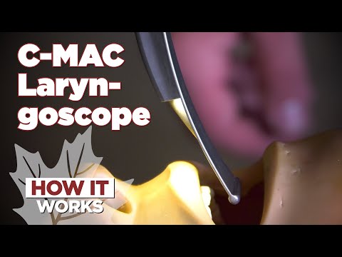 How It Works - C-MAC Laryngoscope