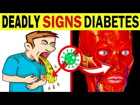 7 DEADLY SIGNS of DIABETES You Can't Ignore (Diabetic Ketoacidosis)