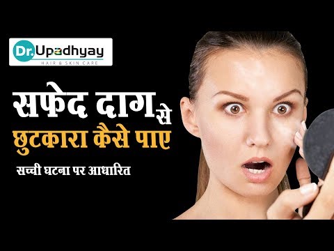 Pimples Treatment in India
