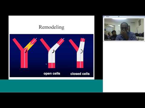 Stents IAS/PDA/COA/PA stenting including hardwares, stents available Part 1 by Dr Sivakumar