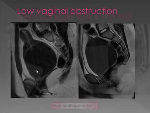 ISMRM MR Academy - Congenital Anomalies
