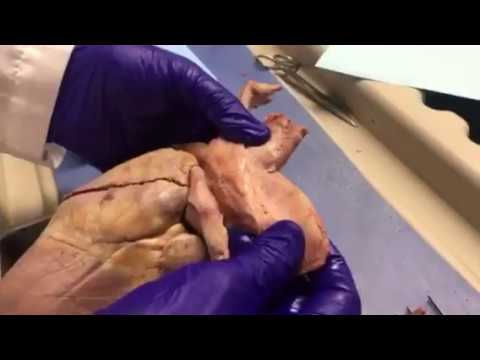Heart Dissection