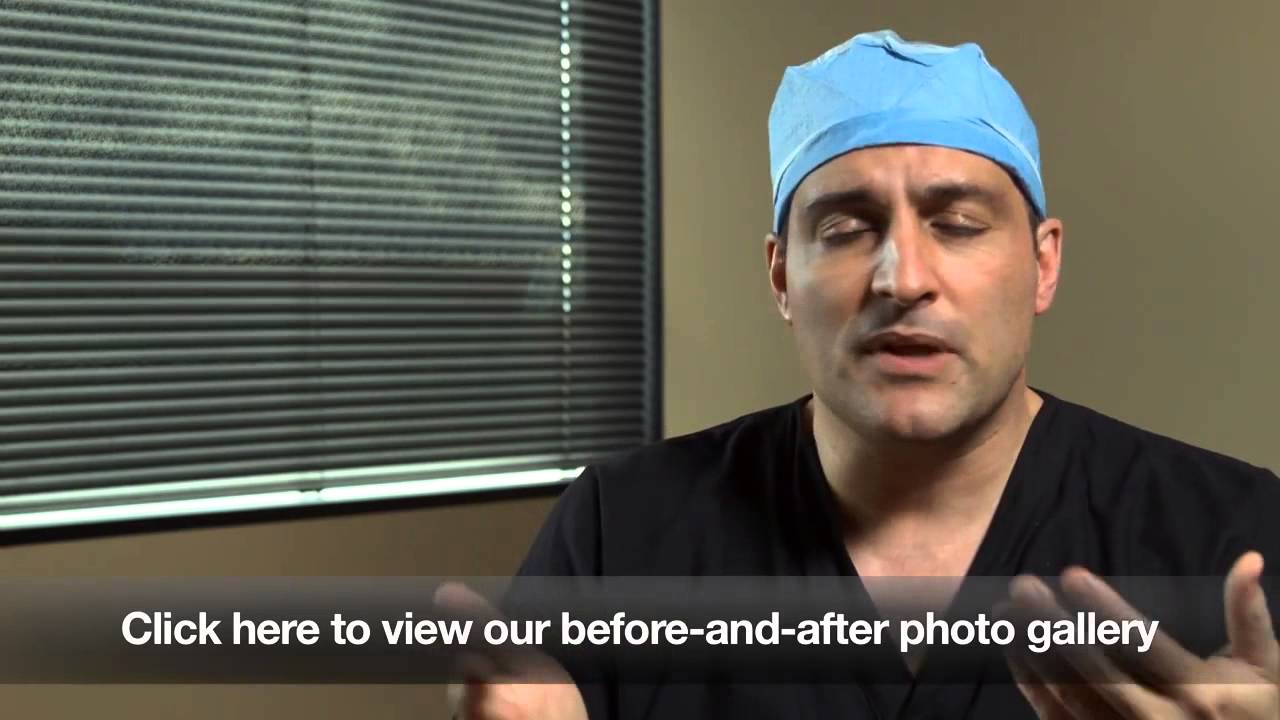 Extended Facelift Seattle & Tacoma | Seattle Plastic Surgery