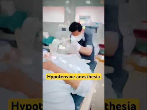 #anesthesiology #hospital #bmc #pregnant #doctor #epidural #nurse #health #fypシ゚viral #trending #1k