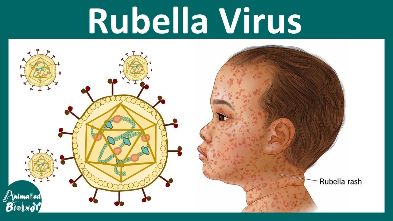 Rubella | German Measles | Rubella virus | pathogenesis, diagnosis and treatment of Rubella