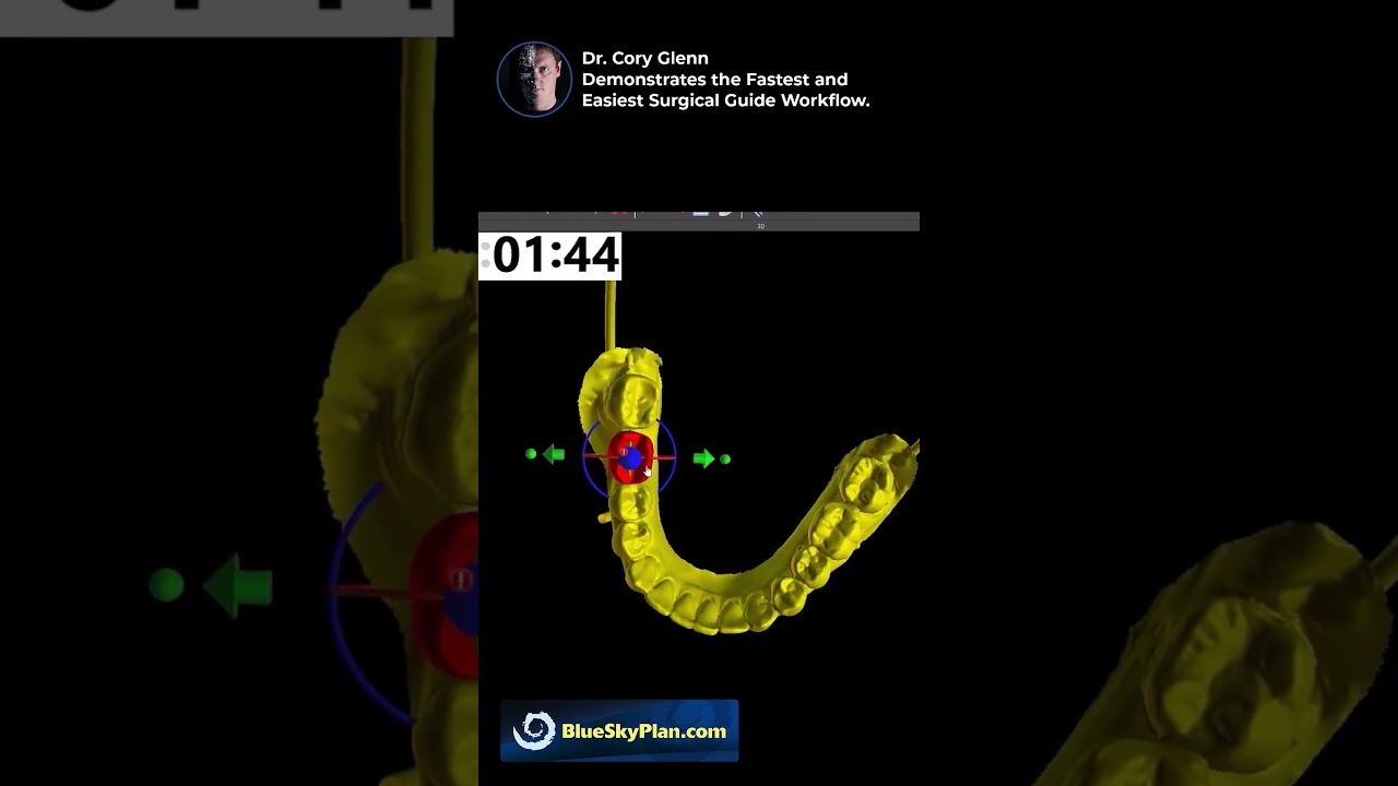 Surgical Guide AI Workflow!  #blueskyplan #surgicalguide #implantology #dentaleducation #dentistry