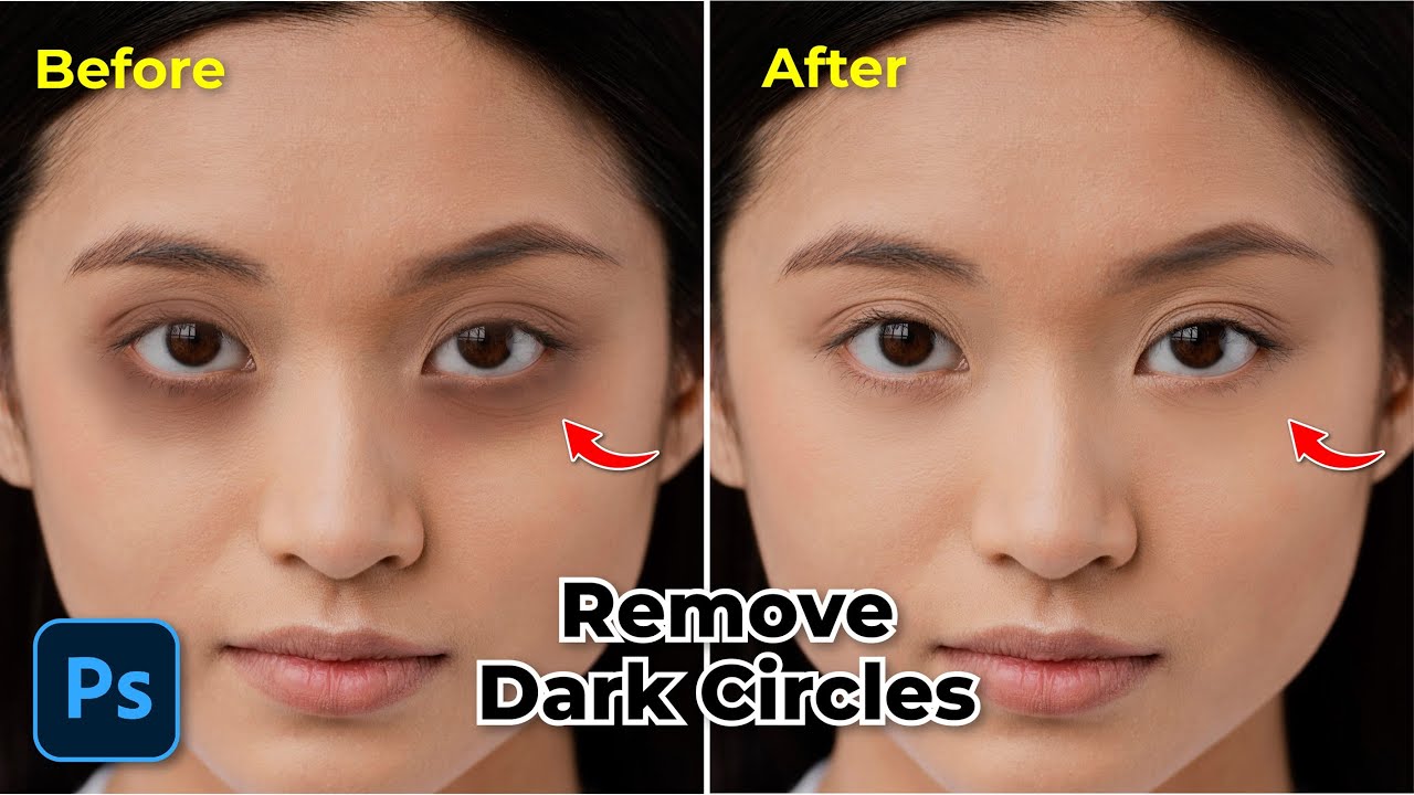 Easy Remove Dark circles under eye in photoshop