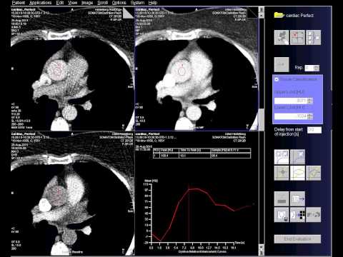 Timing Bolus Definition Flash