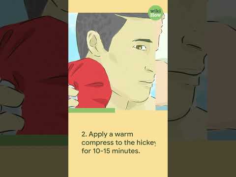 How to Get Rid of a Hickey #shorts