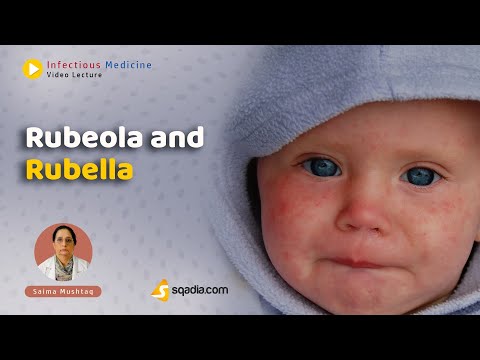 Rubeola and Rubella | Infectious Medicine | sqadia.com