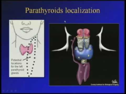 3D Ultrasound in the Evaluation of Small Parts